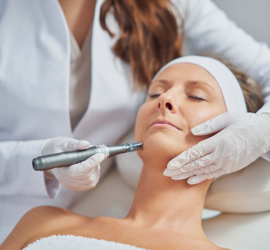 Can an Esthetician Perform Microneedling? Exploring the Role of Esthet ...