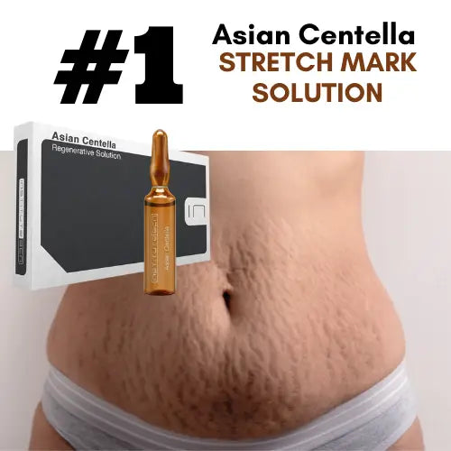 ASIAN CENTELLA, Stretch Mark Solution. – Dermishop
